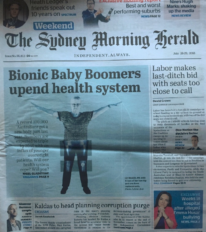 Bionic boomers1 | Nigel Gladstone